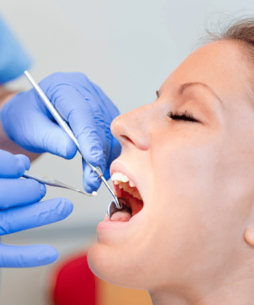 Dental Health and Tooth Filling: All You Need to Know - Oyster Dental